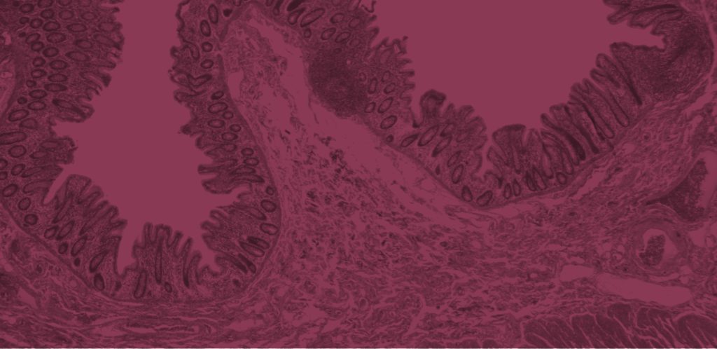 Our expertise: Clinical teams - ICGH